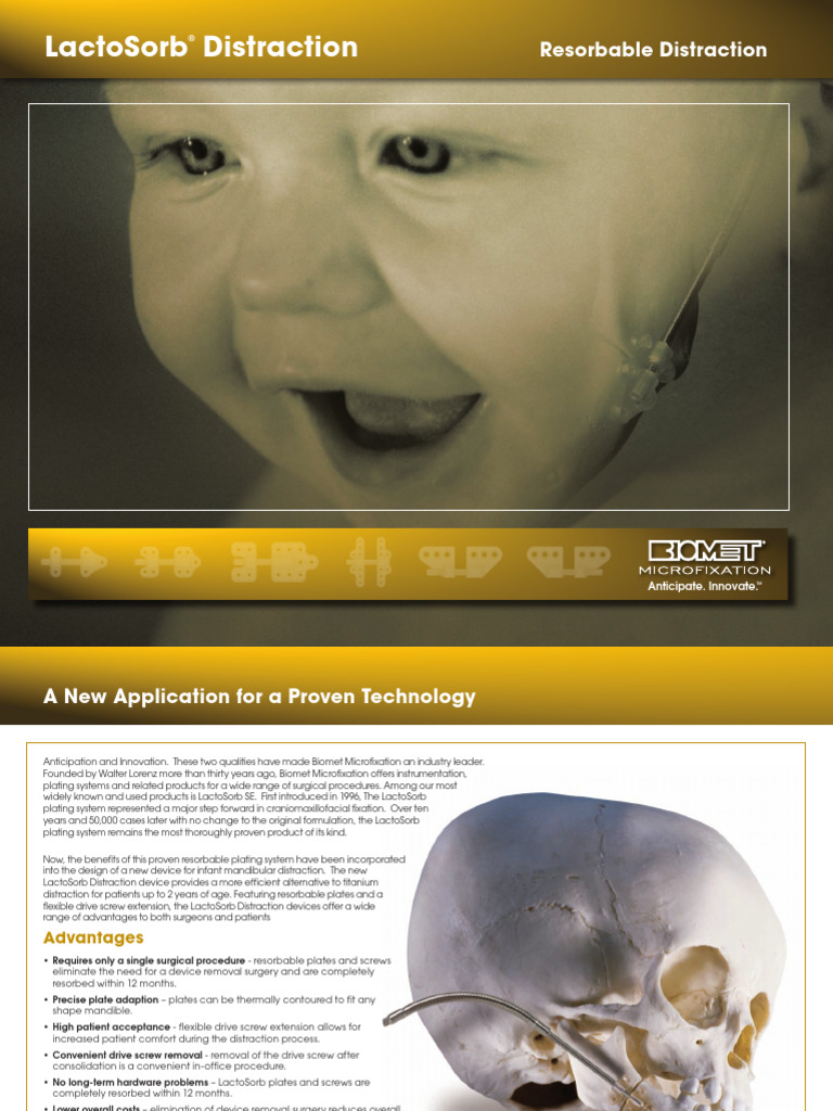 Biomet Microfixation LactoSorb Distraction | PDF | Screw | Medical ...