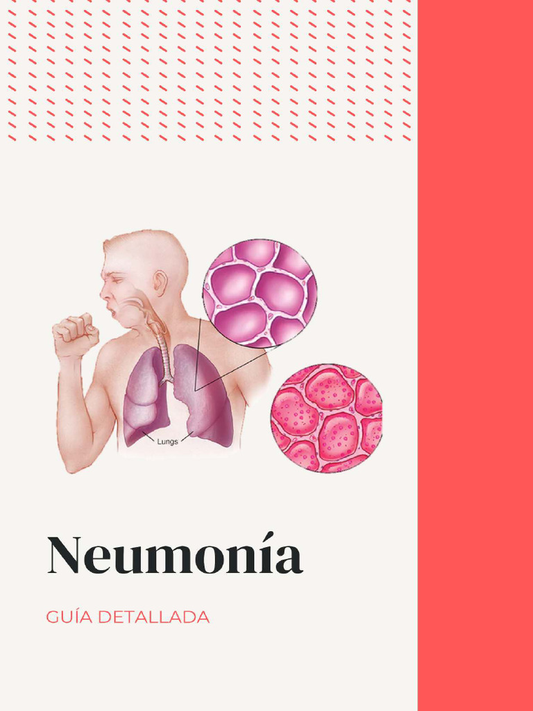Neumonia Neumonia | PDF