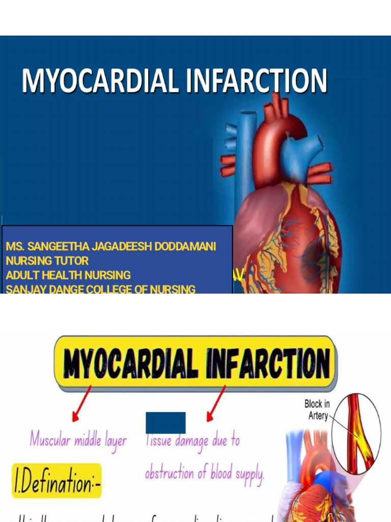 Myocardial Infarction - 3RD Sem Ahn-1 | PDF