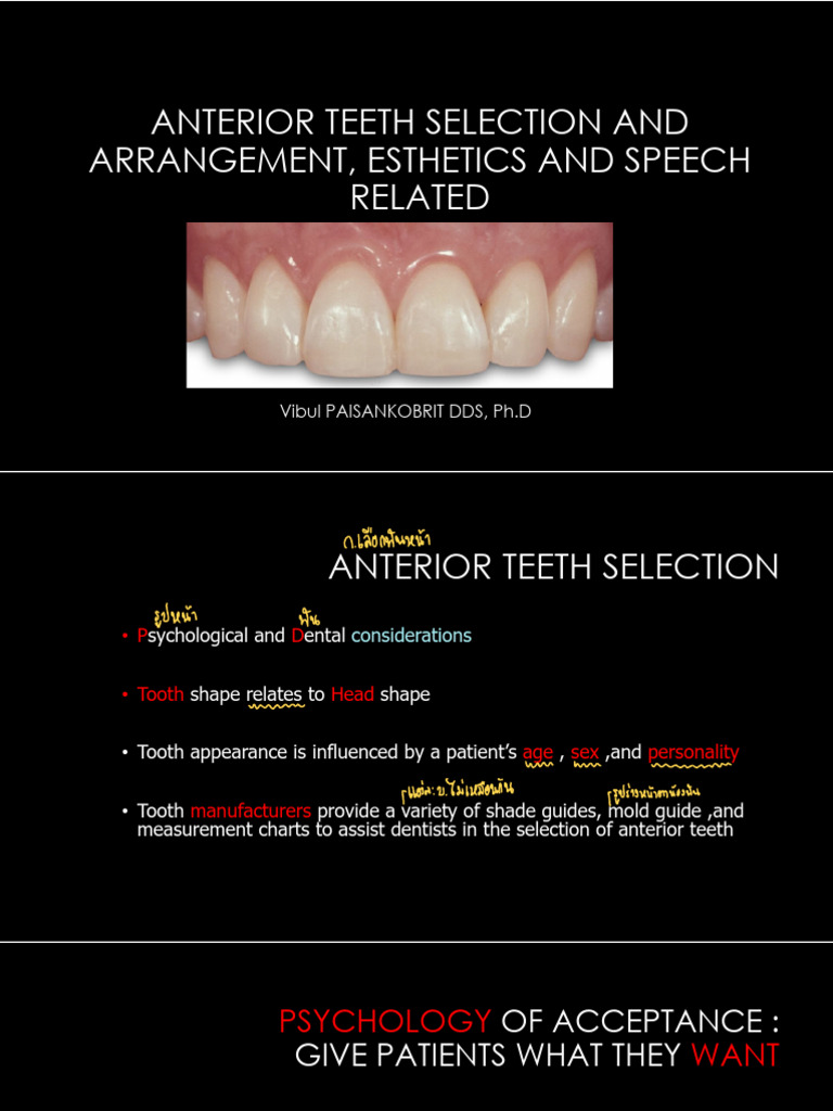 L10 Anterior Teeth Selection and Arrangement, Esthetics and Speech ...