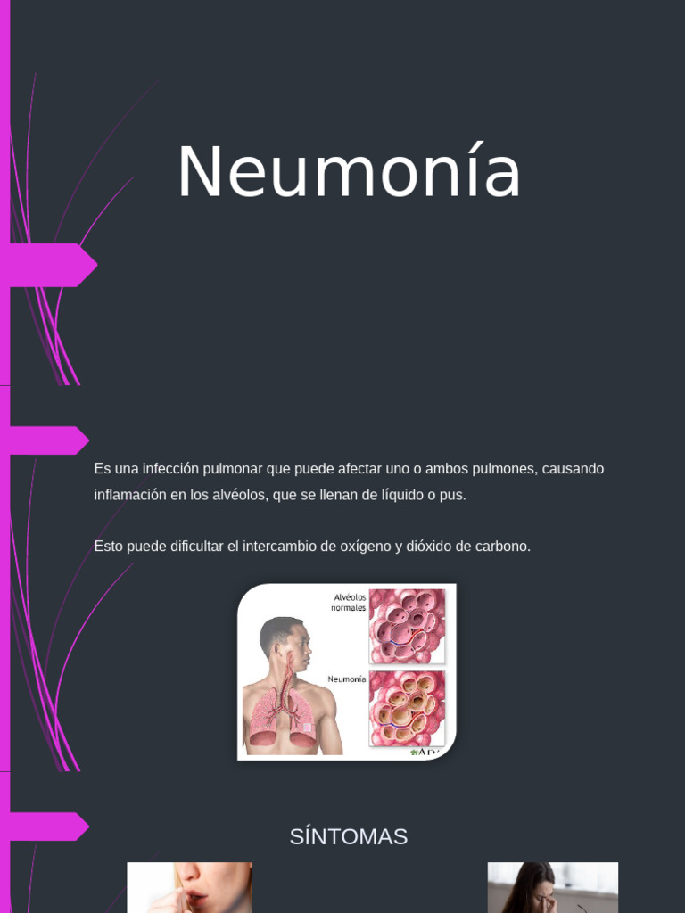 Neumonía | PDF | Neumonía | Especialidades Medicas
