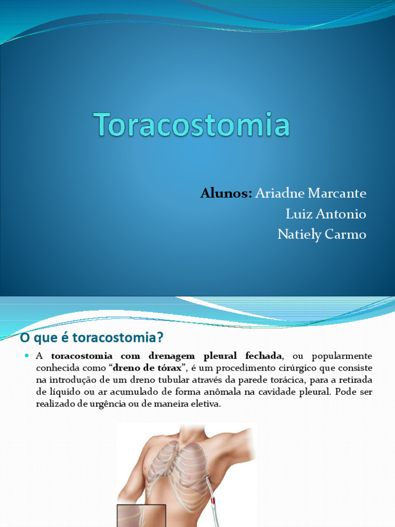 Toracostomia com Drenagem Pleural Fechada | PDF | Especialidades ...