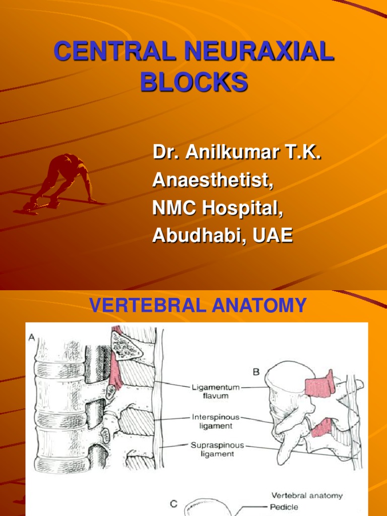 Central Neuraxial Blocks: Dr. Anilkumar T.K. Anaesthetist, NMC Hospital ...