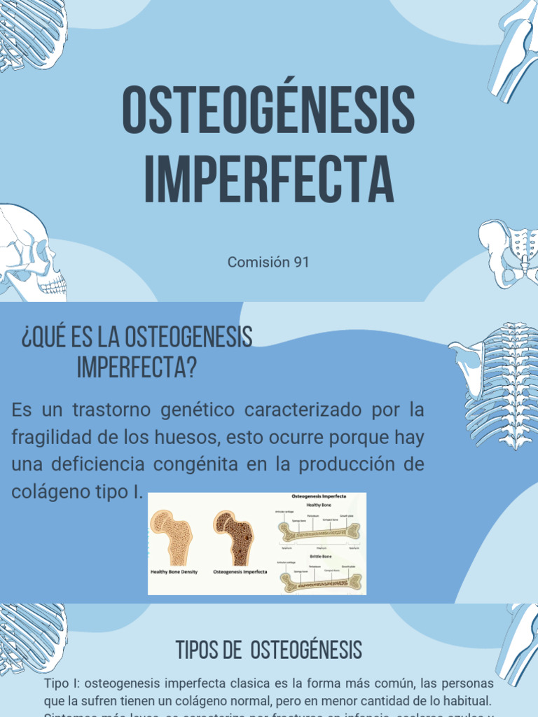 Presentación Osteogenesis Imperfecta | PDF