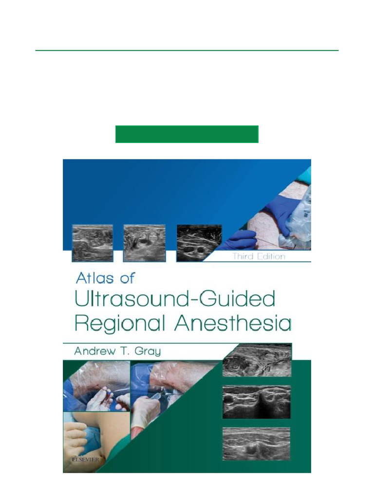 Atlas of Ultrasound Guided Regional Anesthesia 3rd Edition eBook Full ...