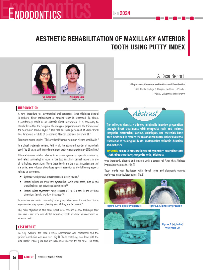 Rehabilitación Estética de Dientes Anteriores Maxilares Utilizando Un ...
