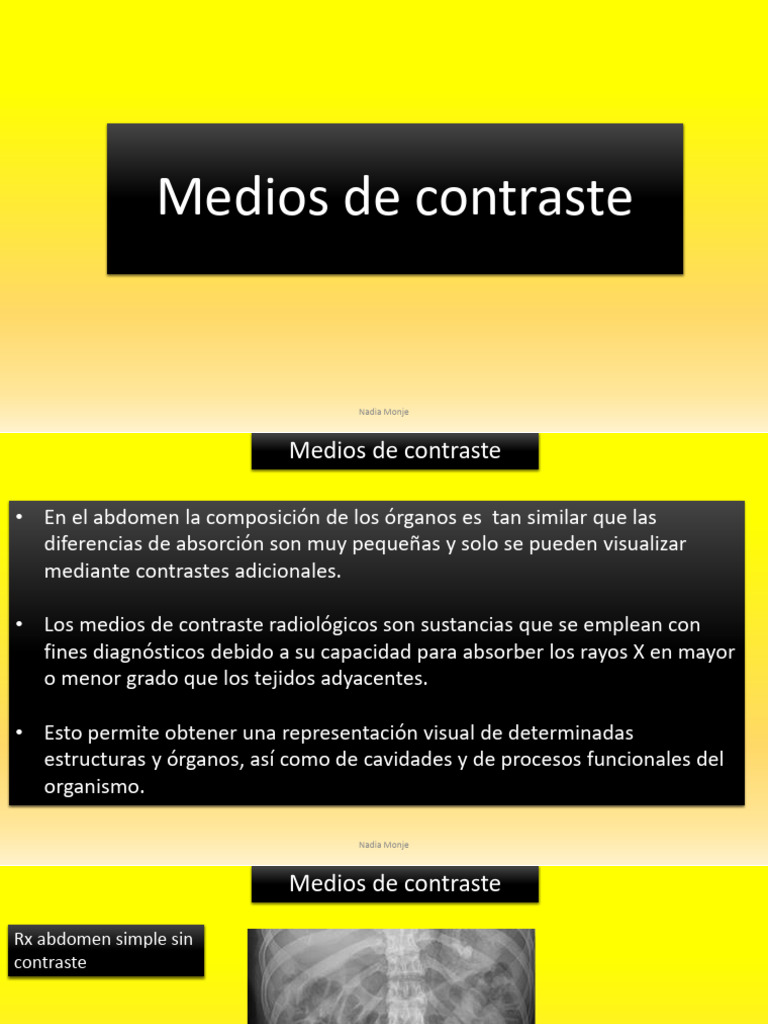 Medios de contraste en diagnóstico por imágenes | PDF | Rayo X ...