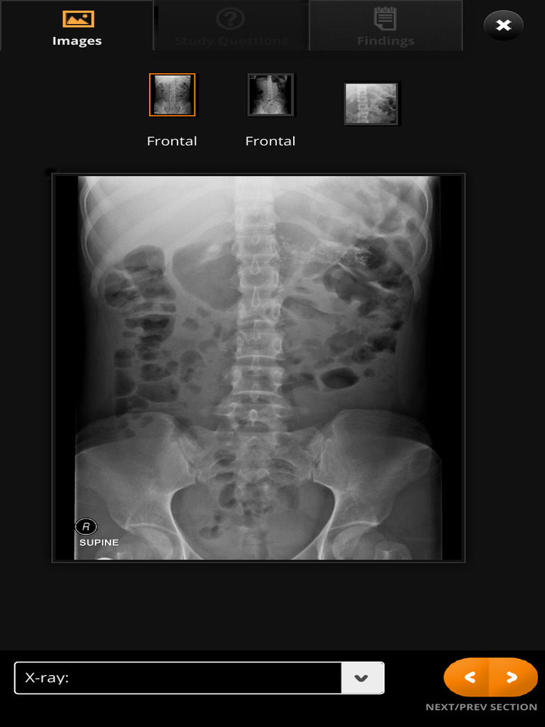 Radiology Quiz 30122 | PDF