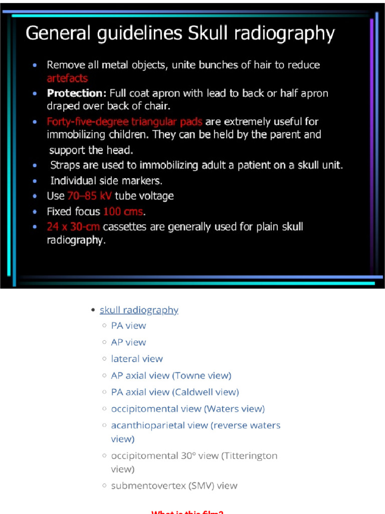 Skull Radiology | PDF