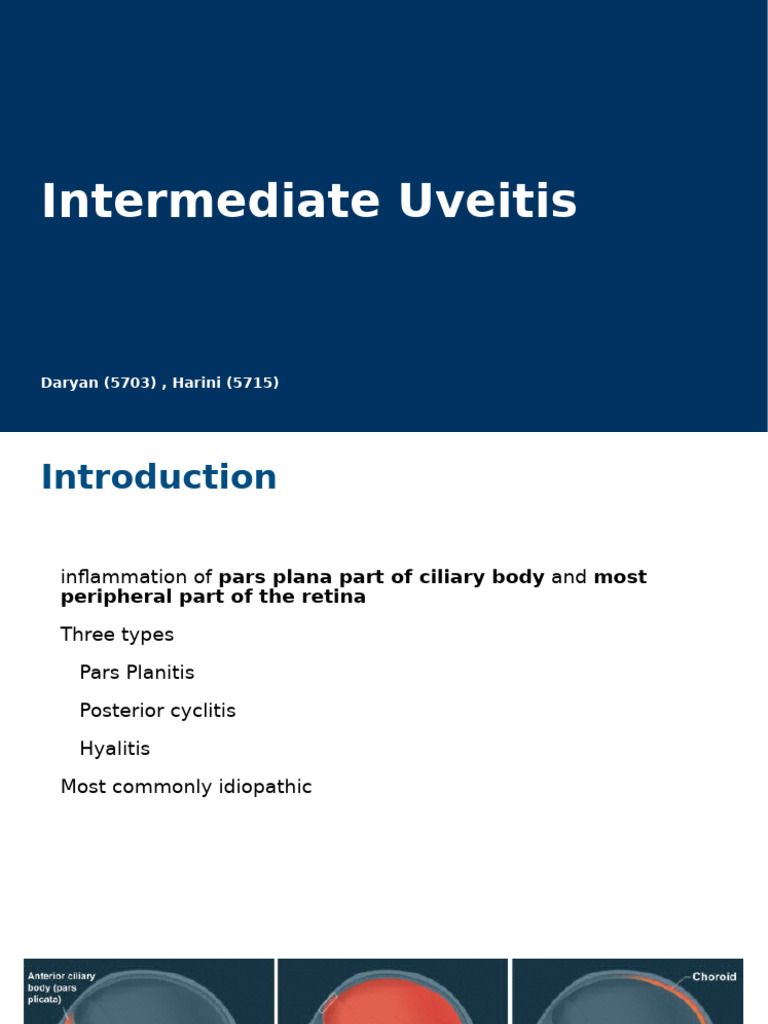 Intermediate Uveitis Seminar | PDF