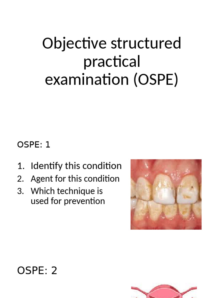 OSPE | PDF