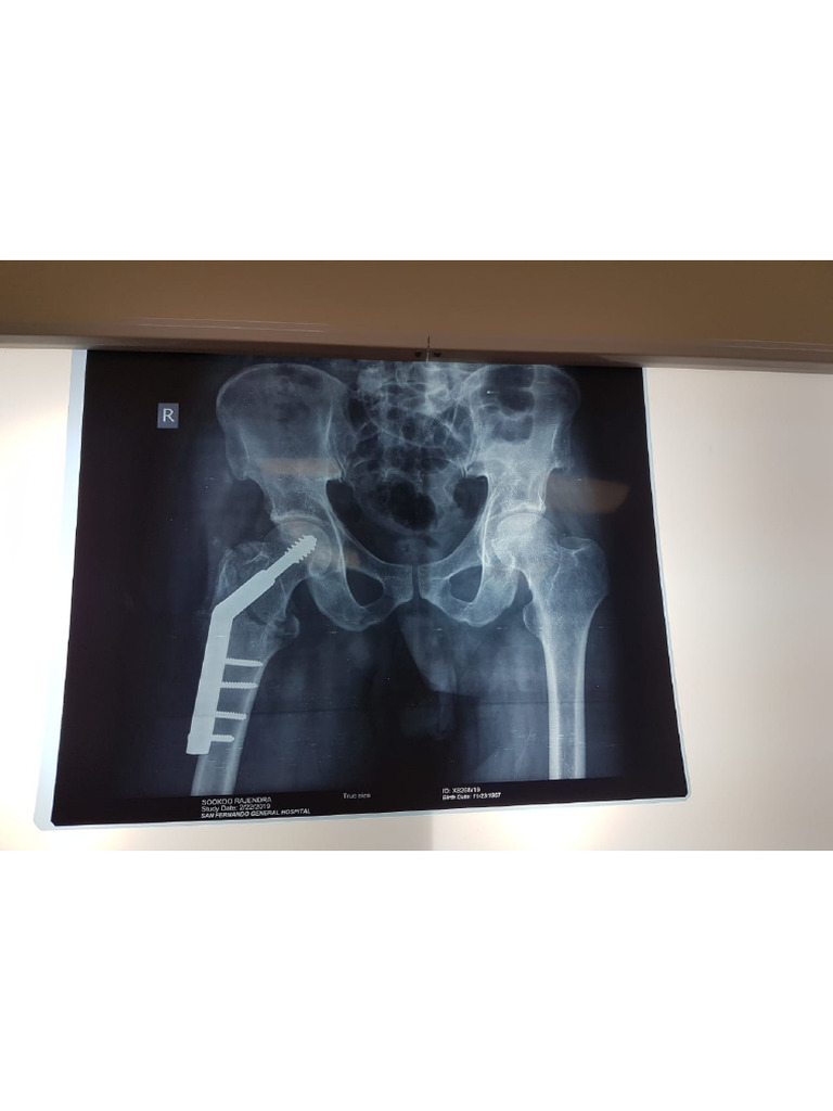 Ortho X-Rays | PDF