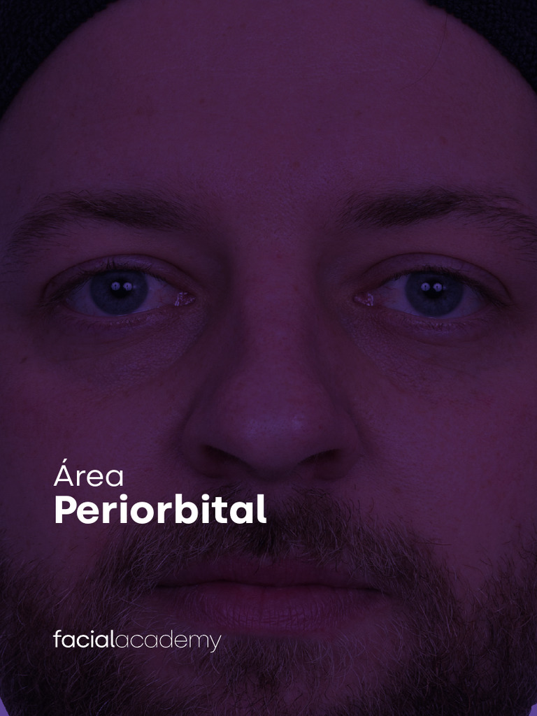Preenchimento Facial: Técnicas e Produtos | PDF