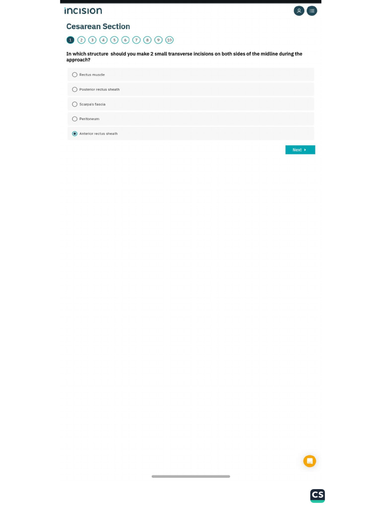 Cesarean Section. | PDF
