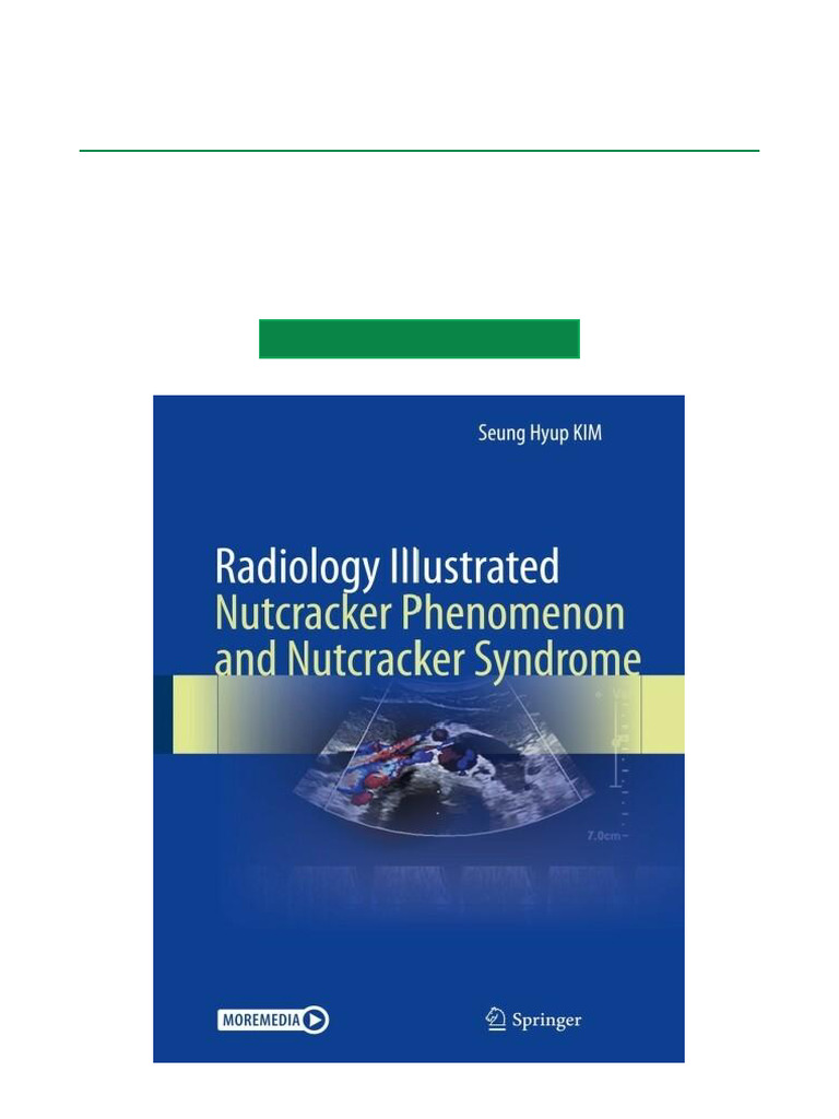 Radiology Illustrated Nutcracker Phenomenon and Nutcracker Syndrome ...