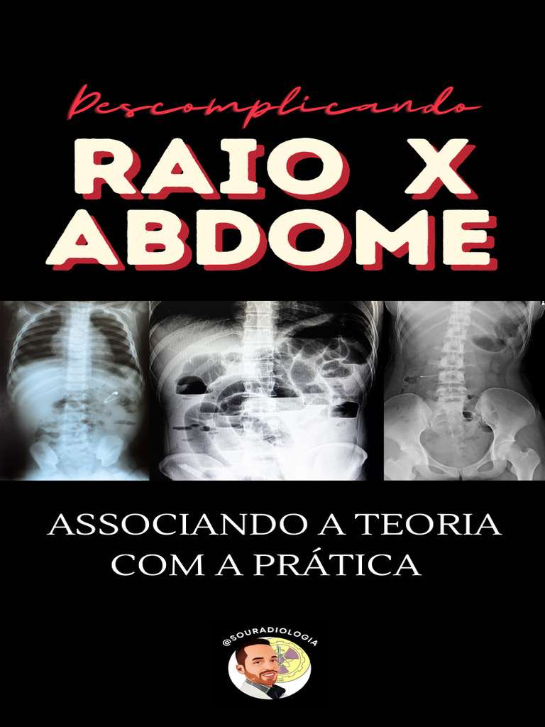 Descomplicando o Raio X Do Abdome | PDF | Radiografia | Rim