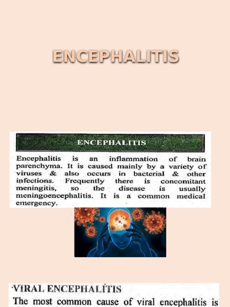 7 Encephalitis | PDF