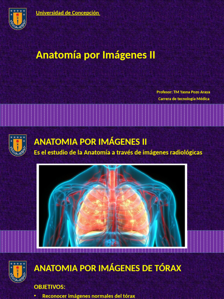 Anatomía en Imágenes II Clase 1 | PDF | Tórax | Tórax (anatomía humana)
