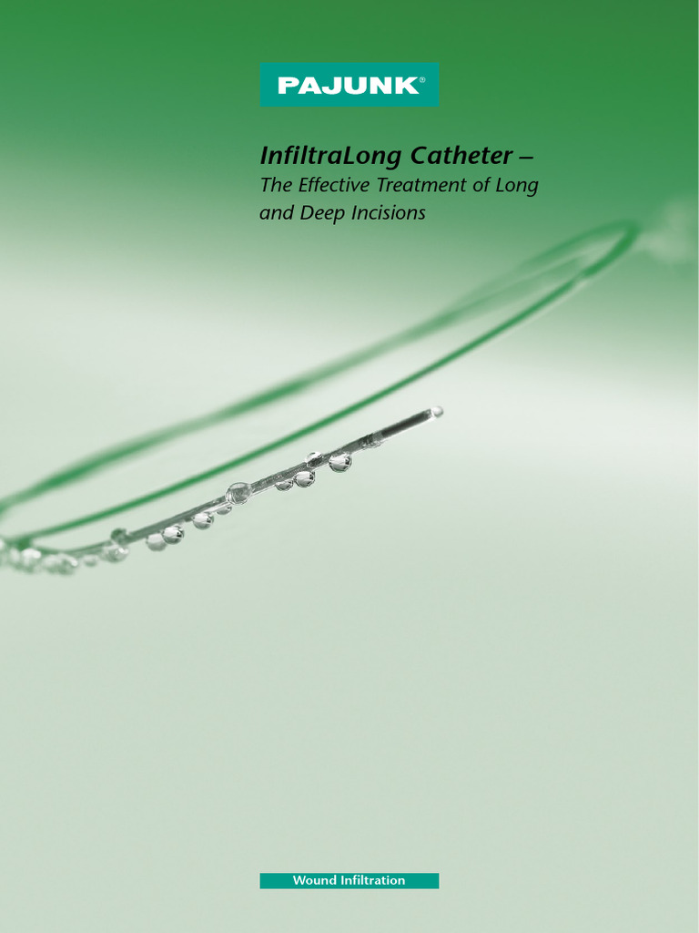 InfiltraLong Catheter for Pain Management | PDF | Abdomen | Anesthesia
