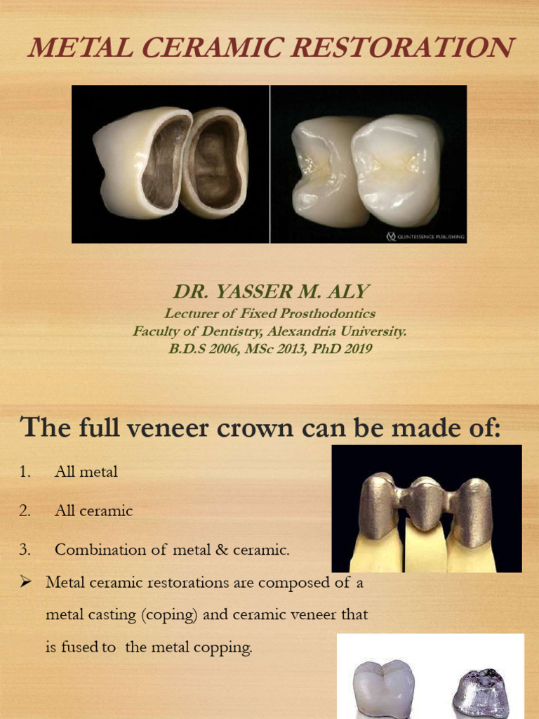 Metal-Ceramic Bonding in Dentistry | PDF | Metals | Alloy