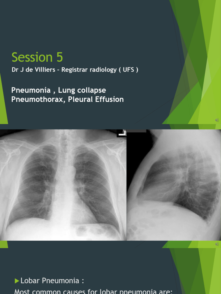 Pneumonia and Lung Collapse Radiology Guide | PDF | Pneumonia | Lung