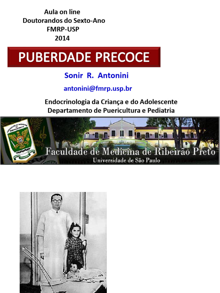 Puberdade Precoce (Slides) | PDF | Puberdade | Sistema endócrino