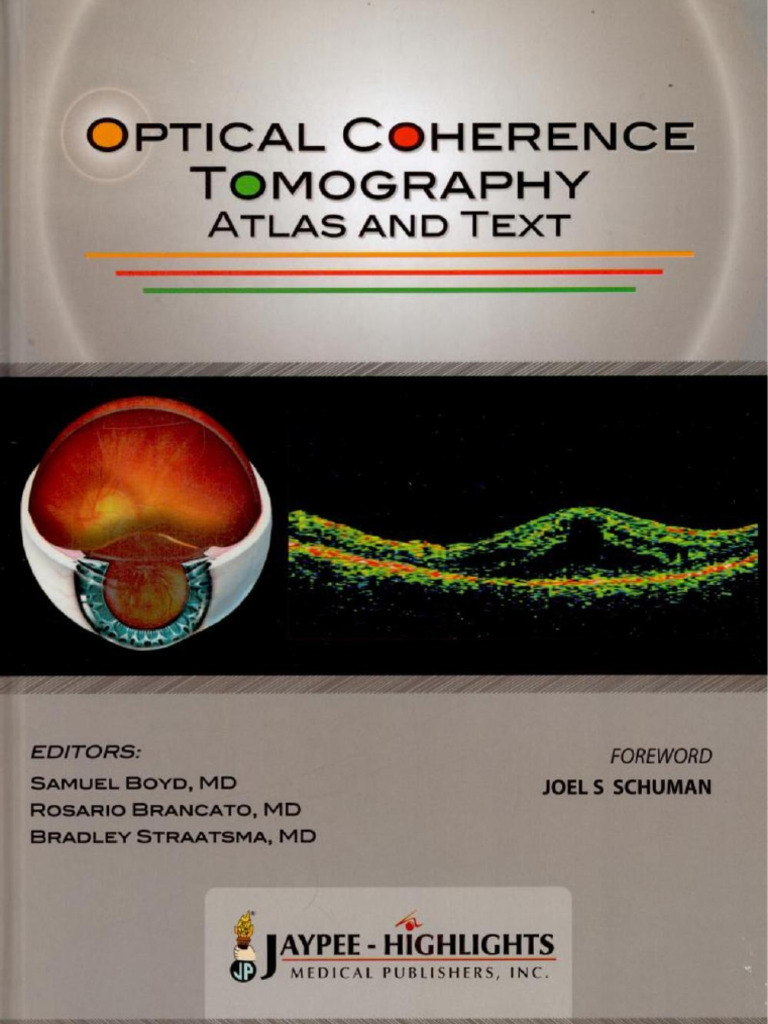 Optical Coherence Tomography-Atlas and Text (PDFDrive) | PDF | Retina ...