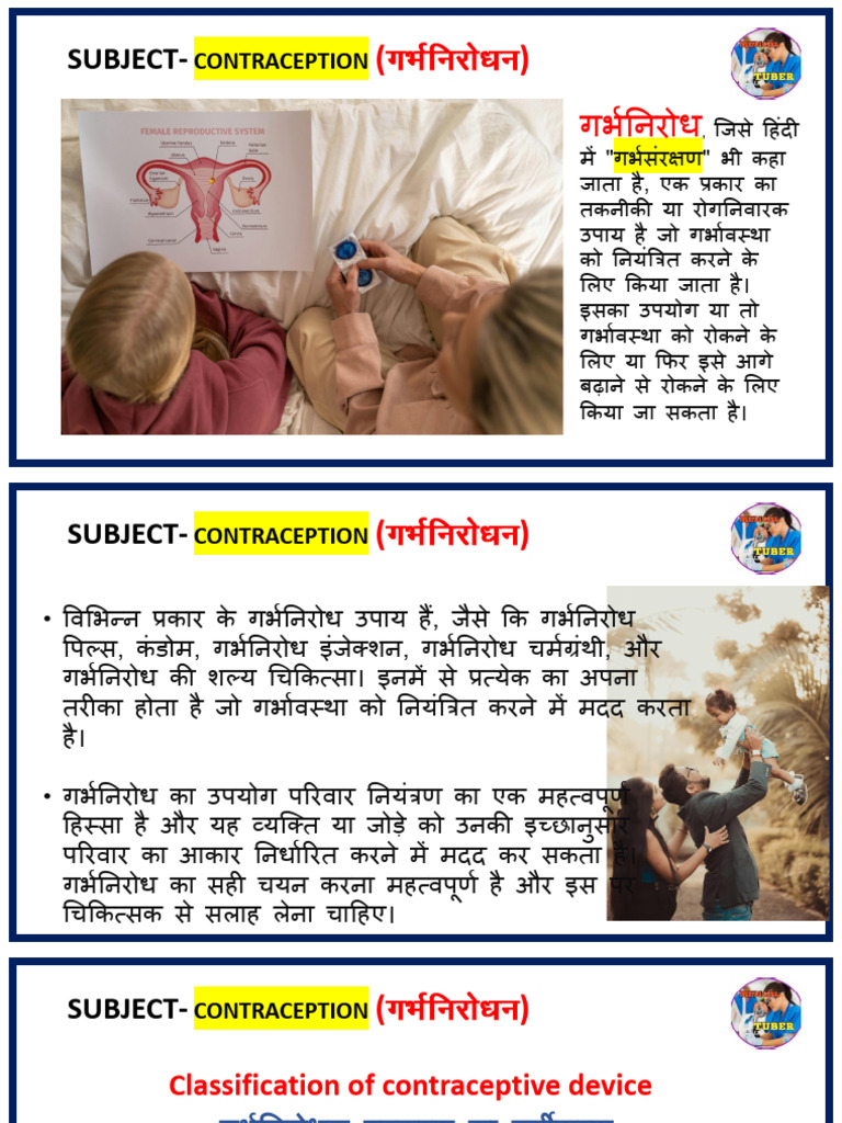 contraception method | PDF