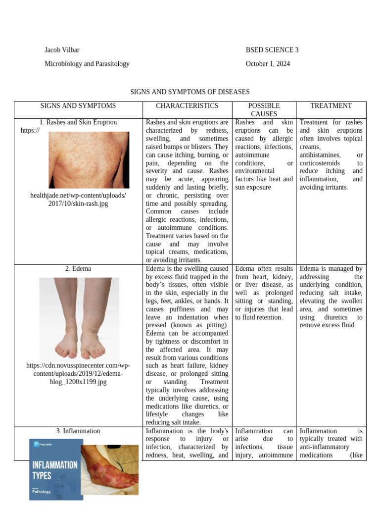 Signs and Symptoms of Disease | PDF | Edema | Autoimmune Disease