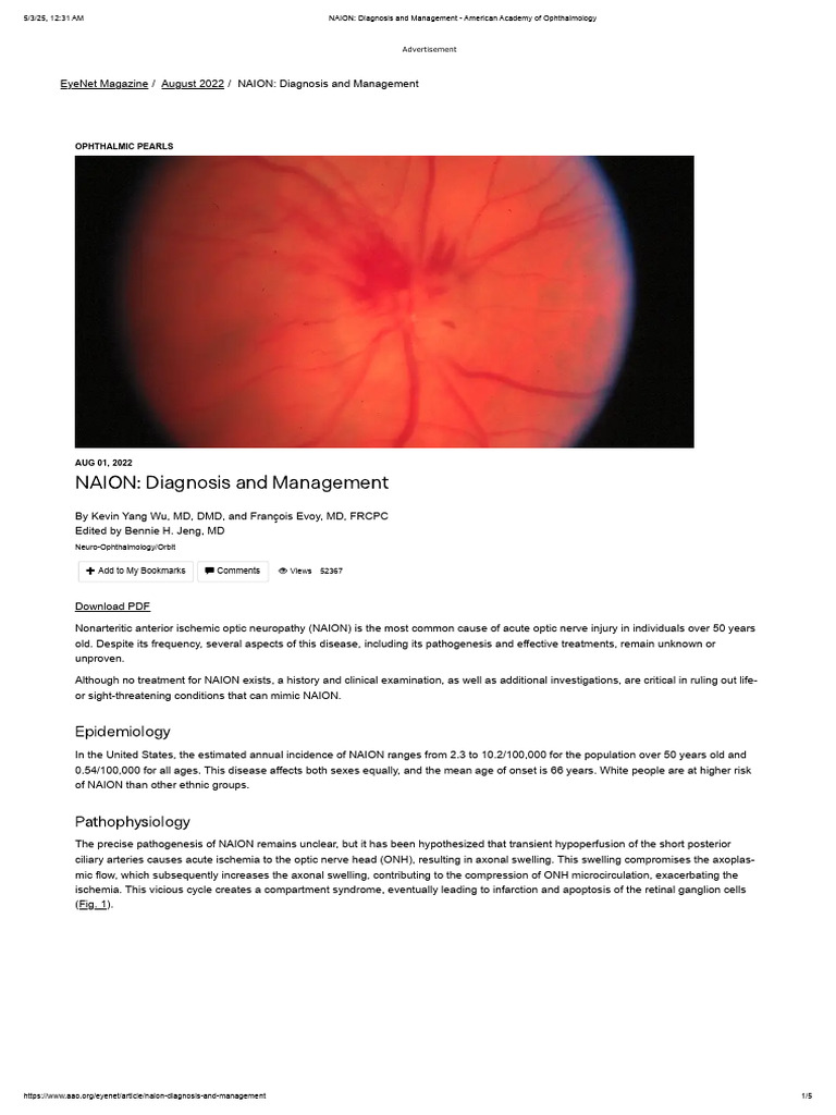 NAION_ Diagnosis and Management - American Academy of Ophthalmology ...
