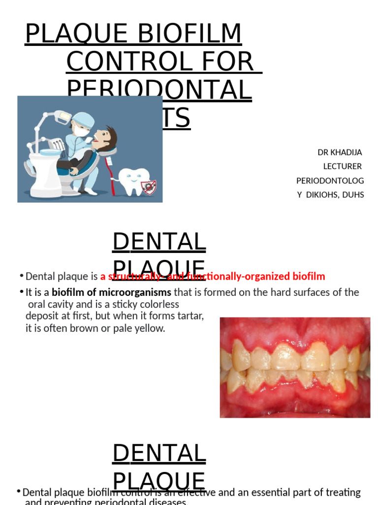 Plaque Control in Periodontal Patients | PDF | Toothbrush | Periodontology