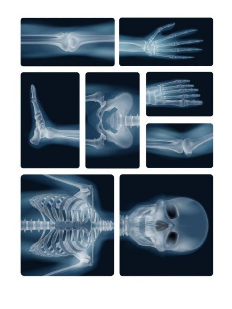Radiografías para Imprimir | PDF