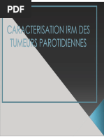 Fracture du rocher : enjeux cliniques | PDF | vertige | Traumatisme crânien