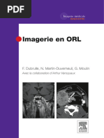 Fracture du rocher : enjeux cliniques | PDF | vertige | Traumatisme crânien