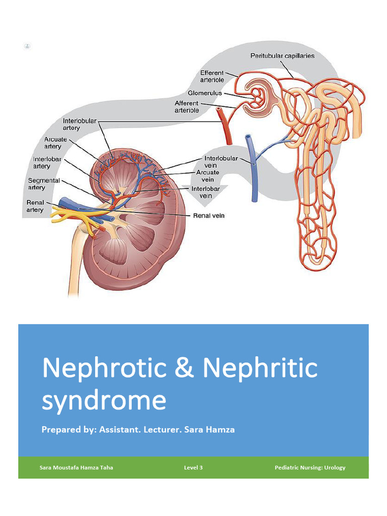 Nephrotic vs. Nephritic Syndrome Overview | PDF | Edema | Kidney