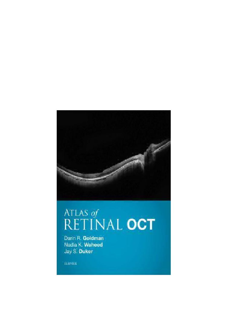 Atlas of Retinal OCT: Optical Coherence Tomography 1st Edition Darin Goldman - Ebook PDF ...