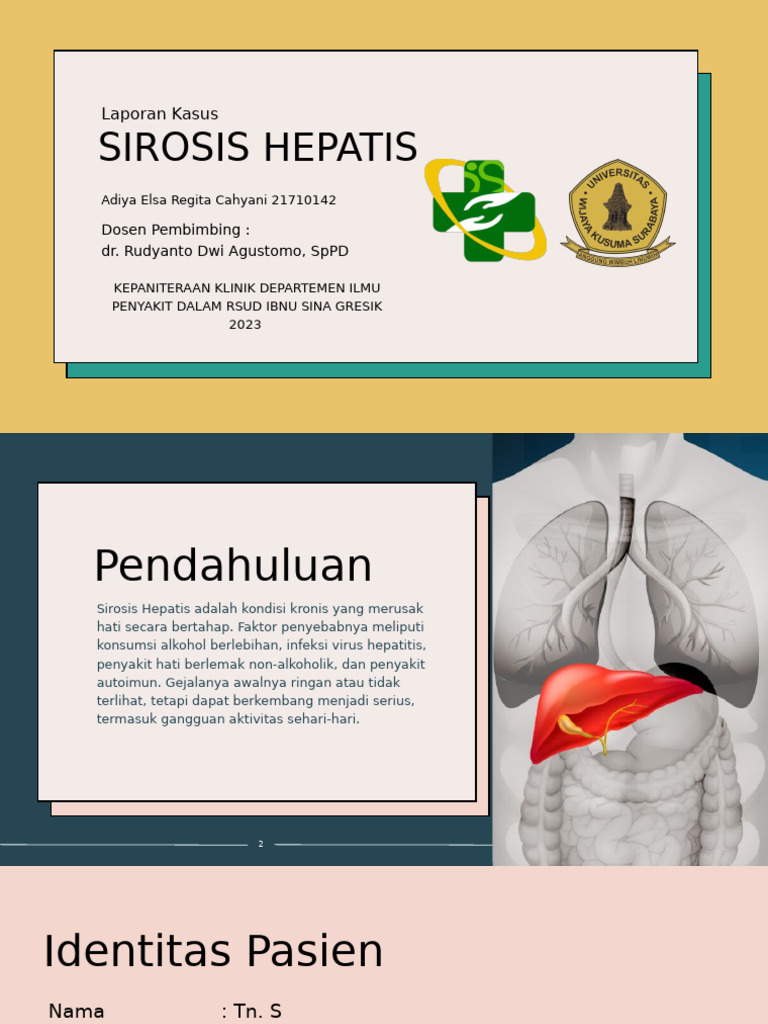 Sirosis Hepatis | PDF