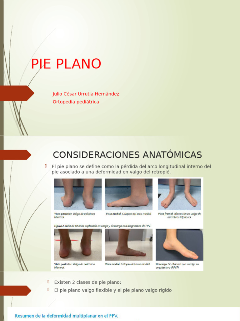 Pie Plano | PDF | Pie | Sistema musculoesquelético