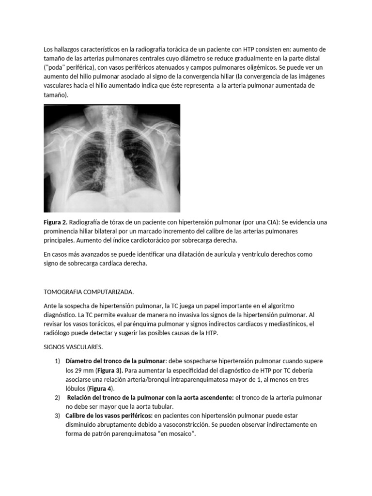 Signos Radiologicos | PDF | Pulmón | Hipertensión