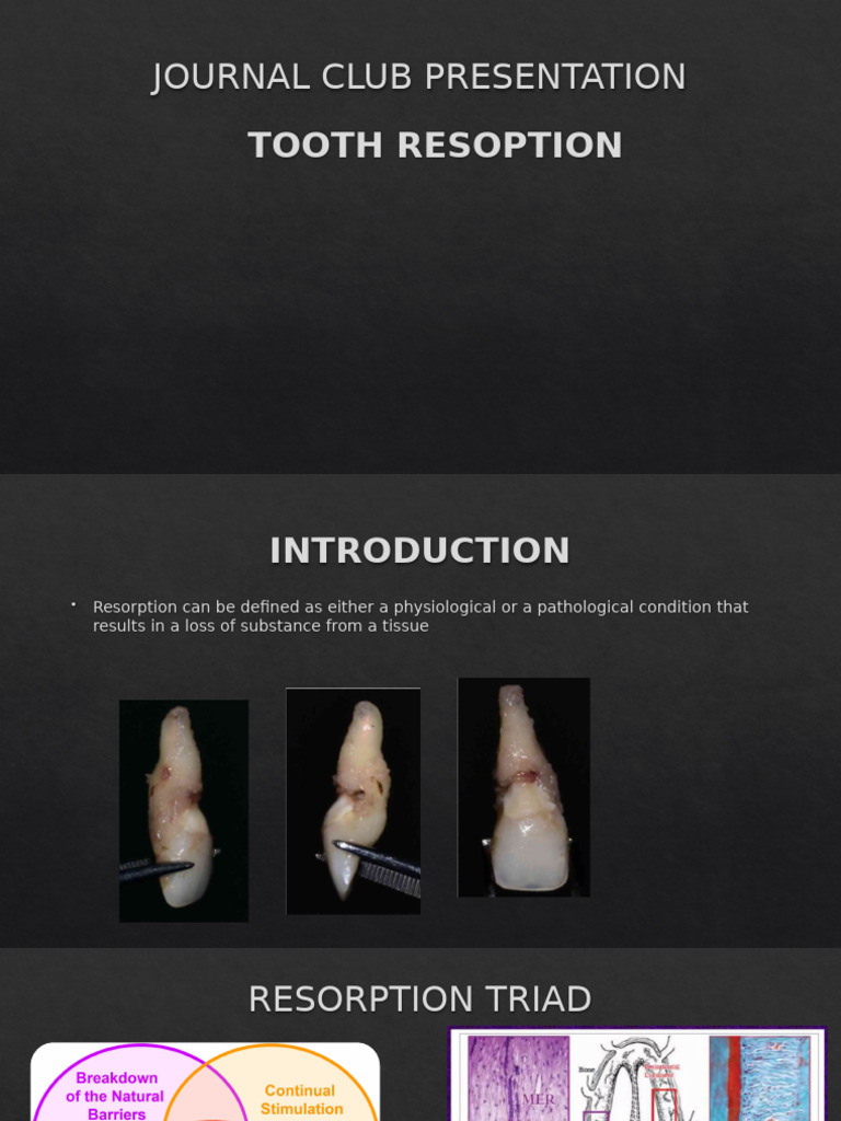 Understanding Tooth Resorption Classifications | PDF | Human Tooth ...