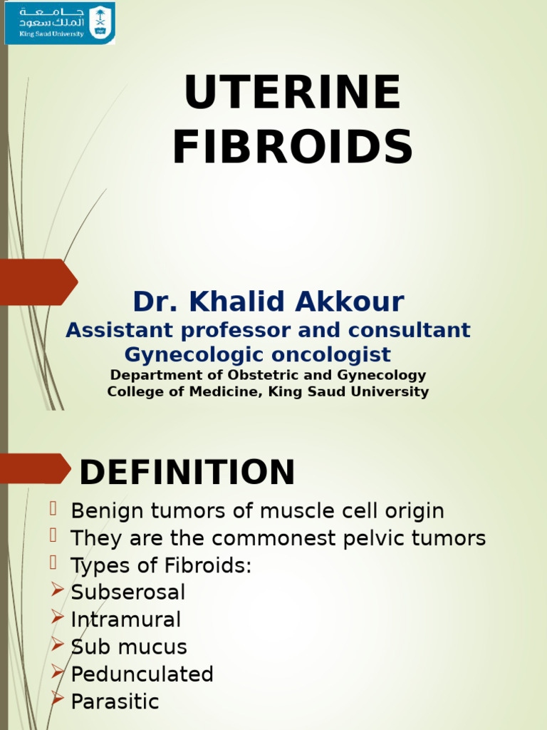 15-Uterine Fibroids | PDF