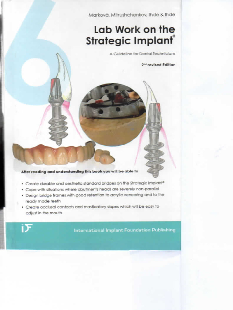 Lab Work On The Strategic Implant | PDF