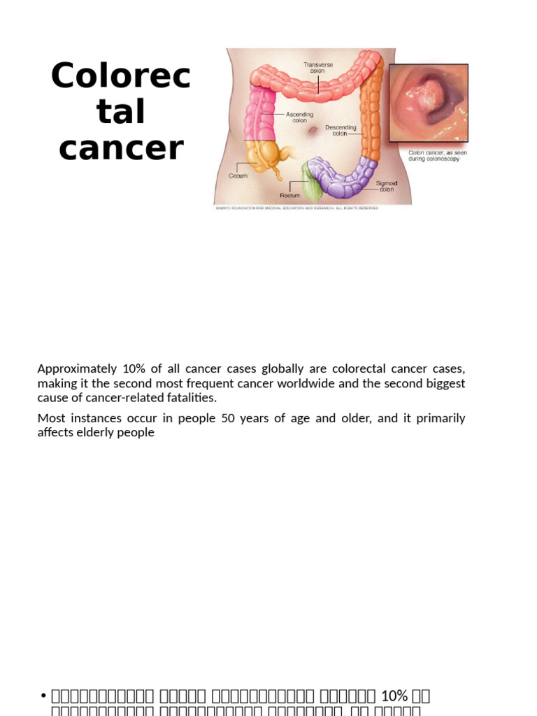 Colorectal Cancer | PDF