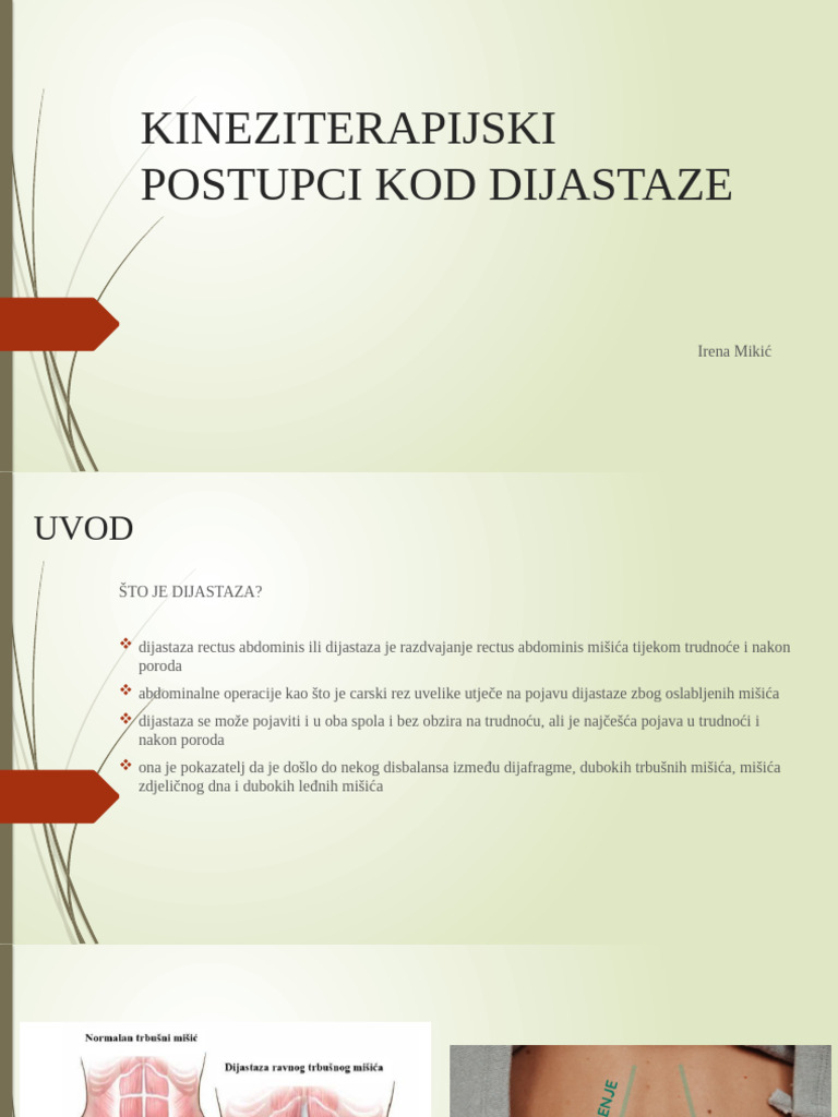 Kineziterapijski Postupci Kod Dijastaze | PDF