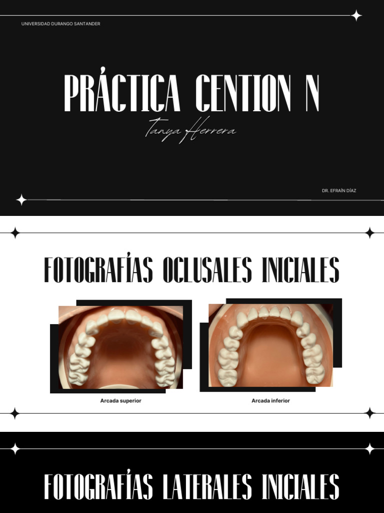 Cention N | PDF | Odontología | Especialidades Medicas