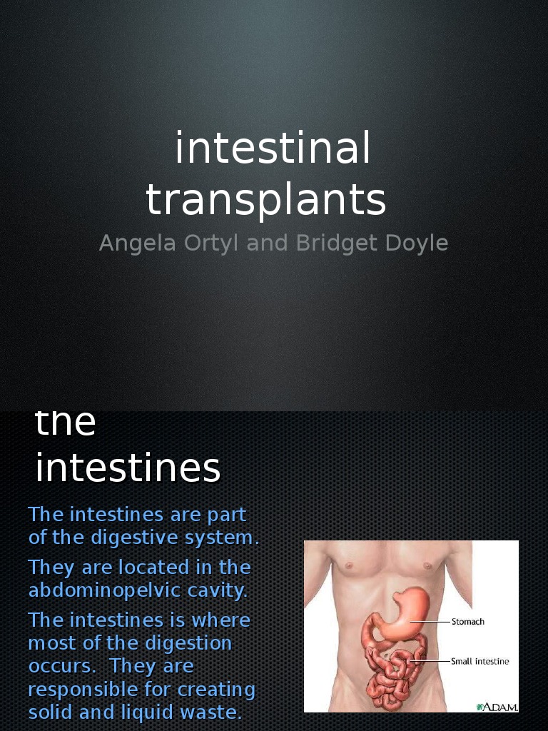 Intestine Transplant Project | PDF | Organ Transplantation ...
