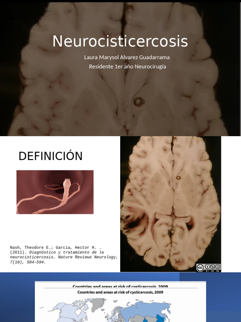 Overview of Neurocysticercosis | PDF