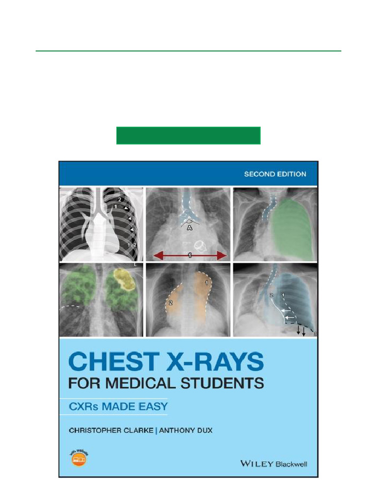 Chest X Rays For Medical Students - 2nd Edition Premium Download | PDF | Respiratory Diseases ...