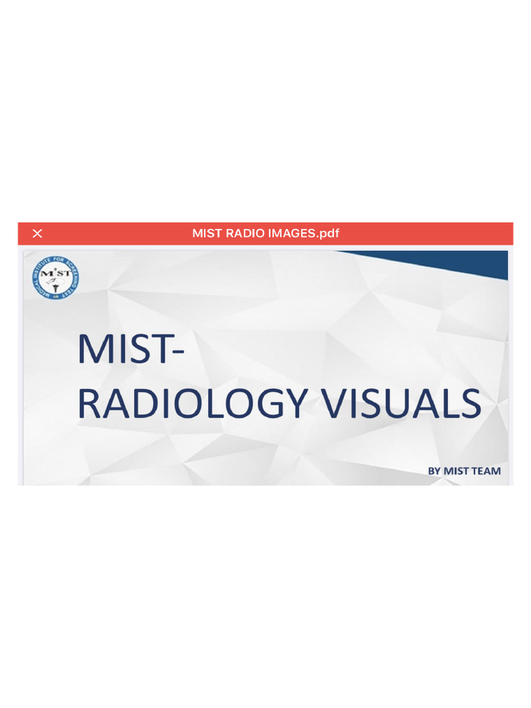 Mist Radiology Images Pdf