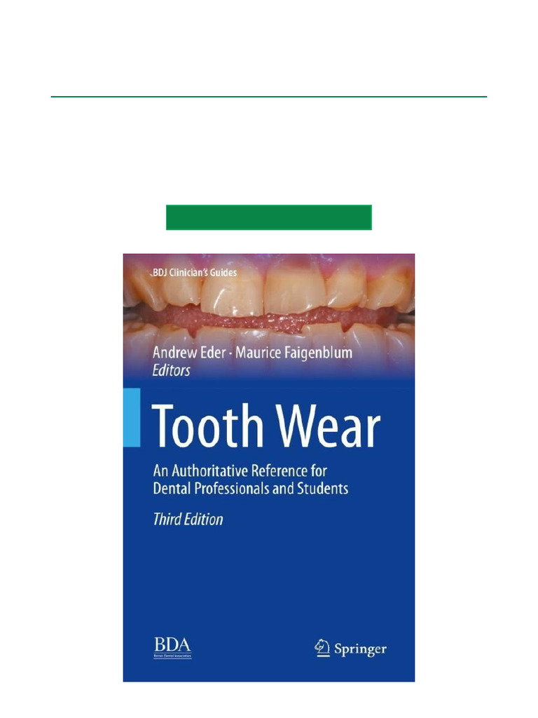 Tooth Wear: A Dental Reference Guide | PDF | Human Tooth | Dentistry